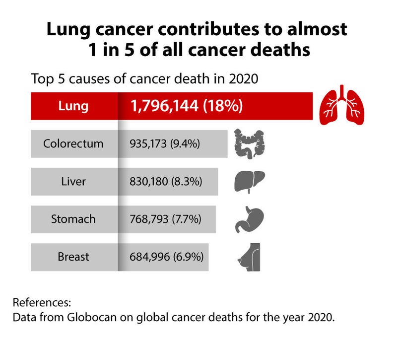 Lung Cancer Screening