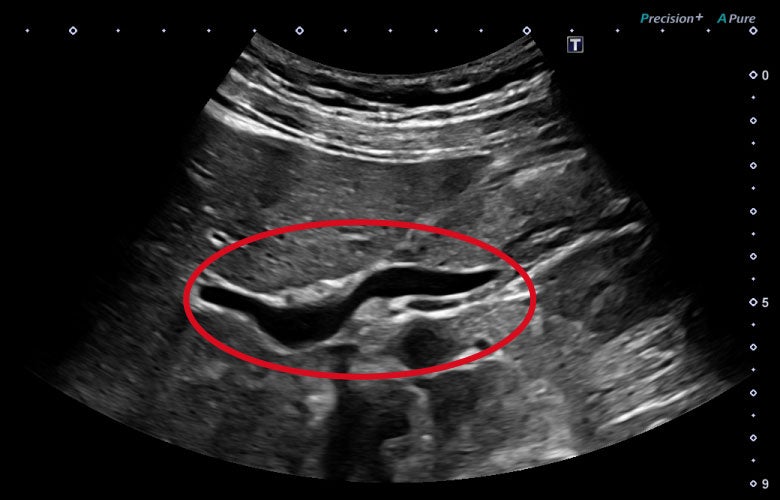 3rd harmonic imaging