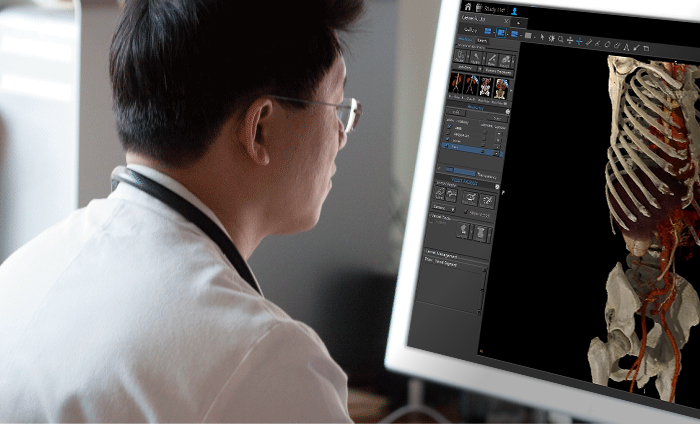 Global Illumination | Vitrea Advanced Visualization | Healthcare IT ...